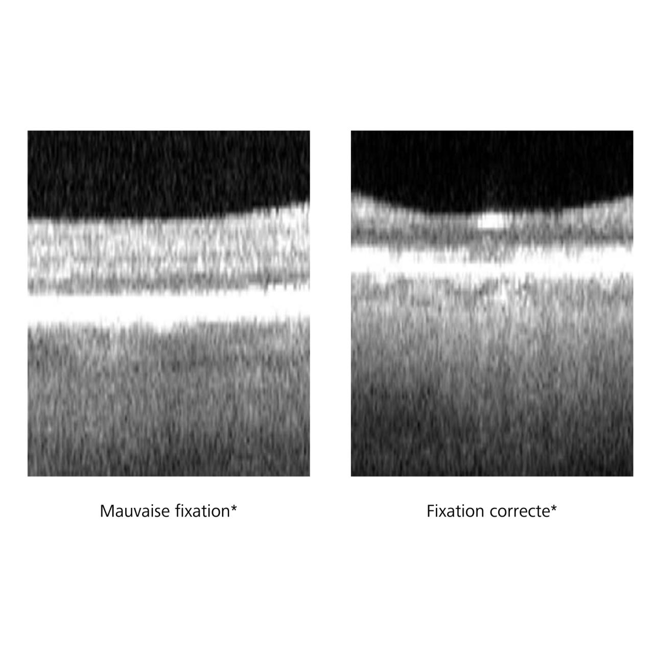 IOLMaster 700 - OCT Swept Source