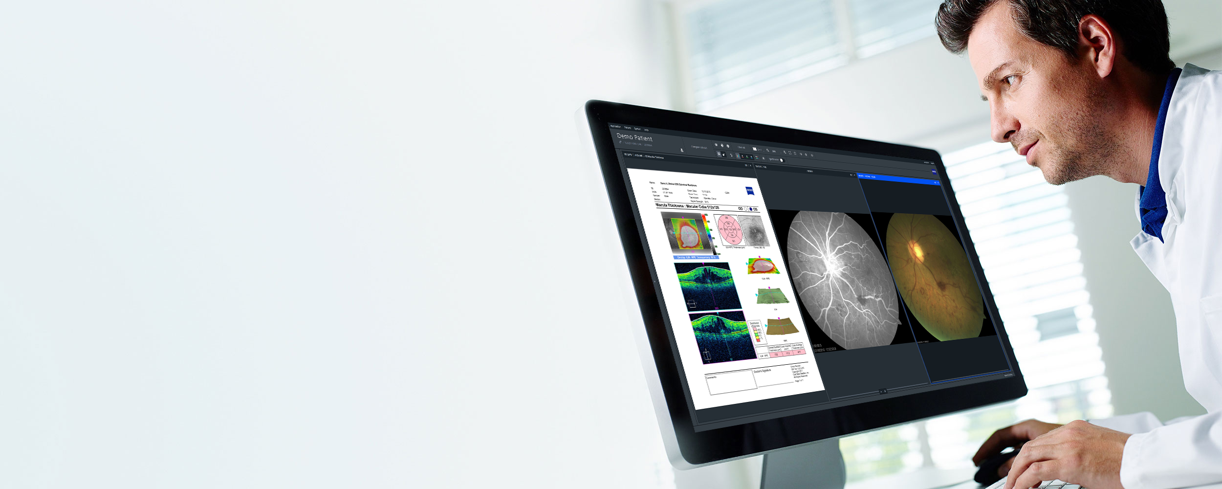 Logiciel d'ophtalmologie FORUM