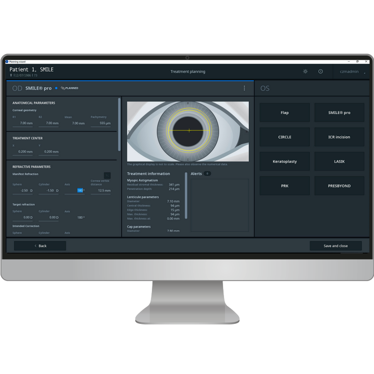 Systèmes de gestion des données ophtalmologiques ZEISS