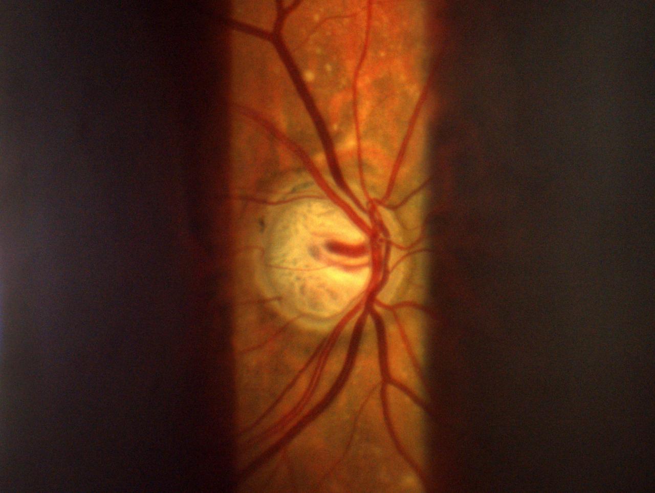 ZEISS SL Imaging Solution