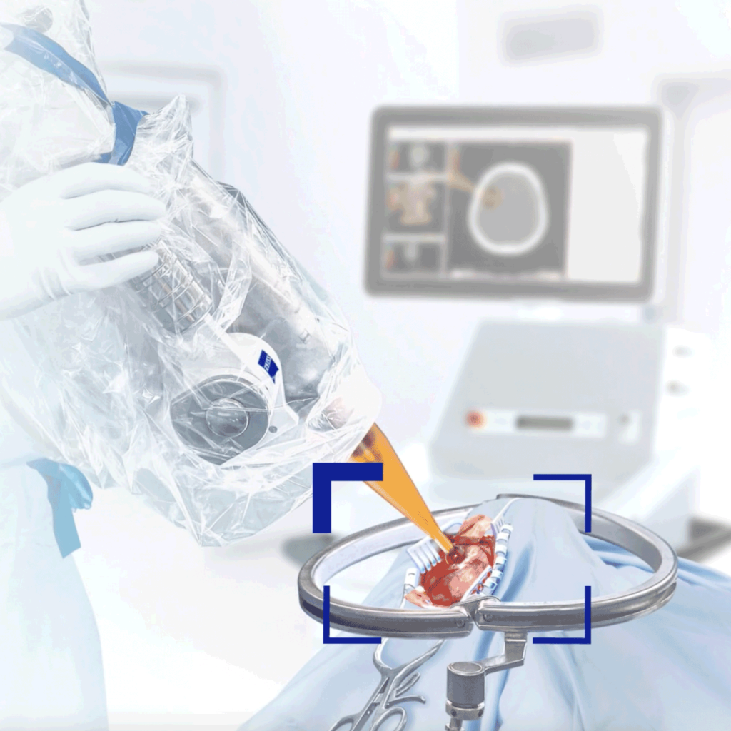 Systèmes de radiothérapie peropératoire ZEISS