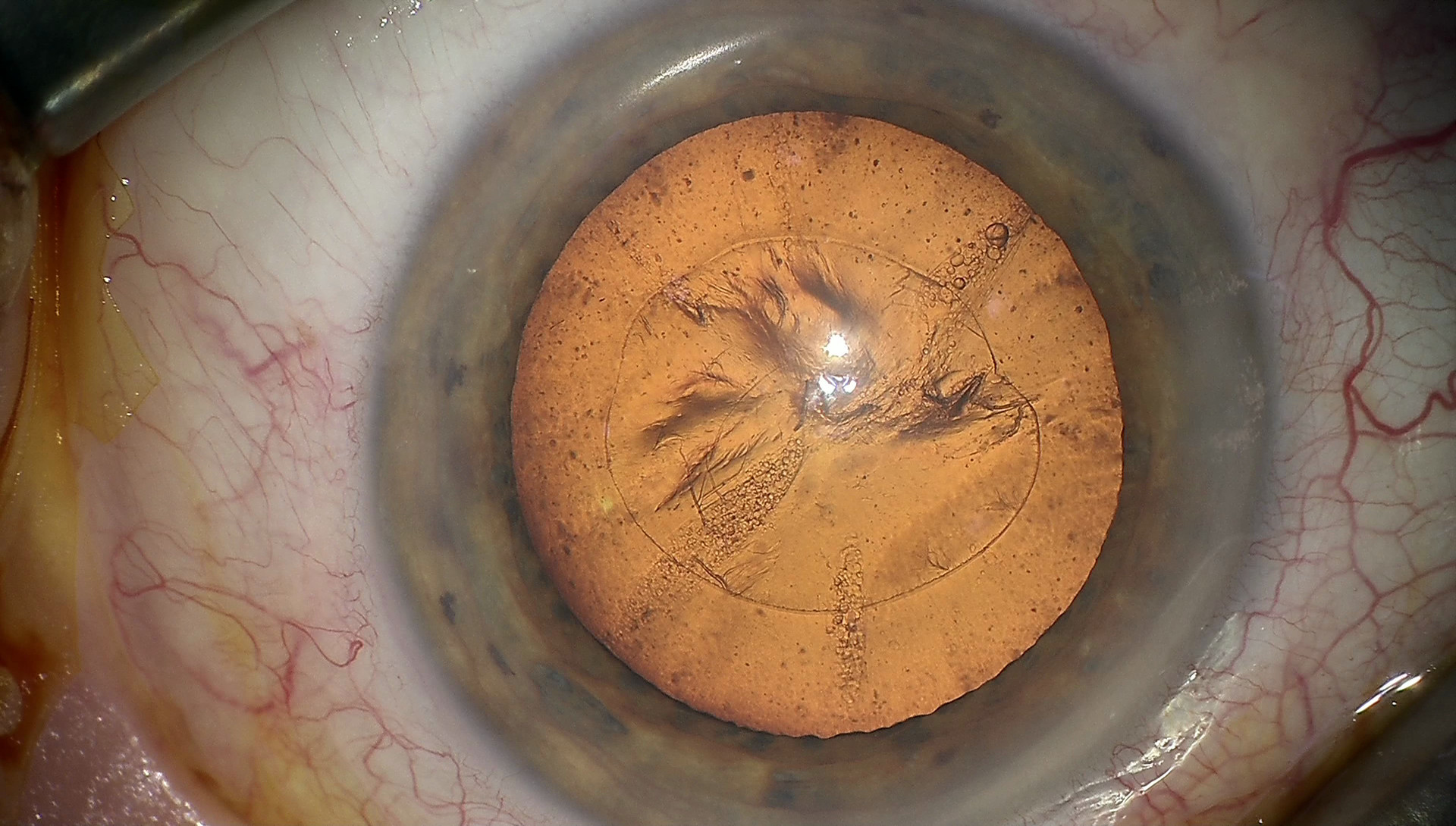 Zeiss Microscope Lumera 300 at Muriel Howard blog