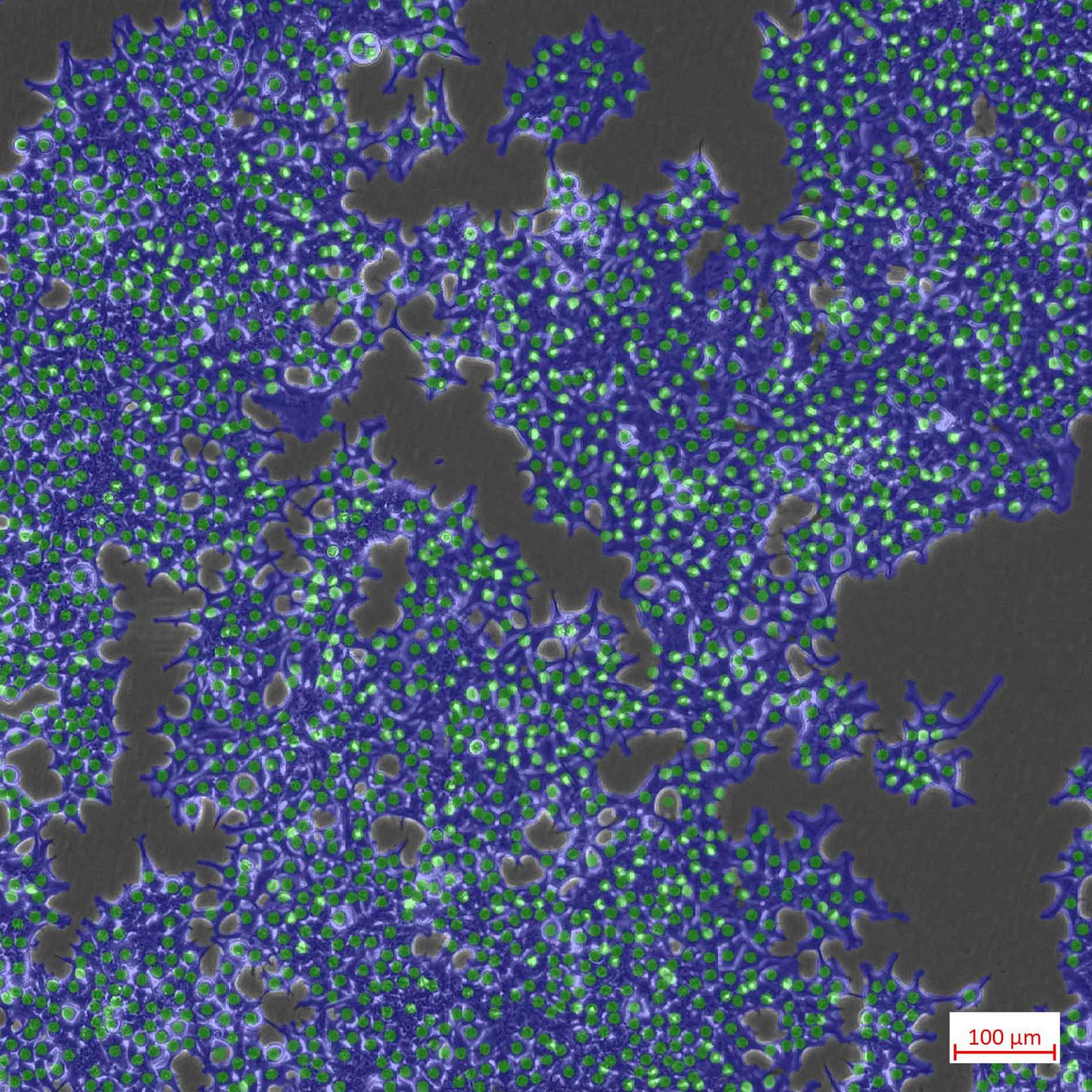 ZEISS Axiovert 5 digital : votre système d'imagerie cellulaire pour l ...